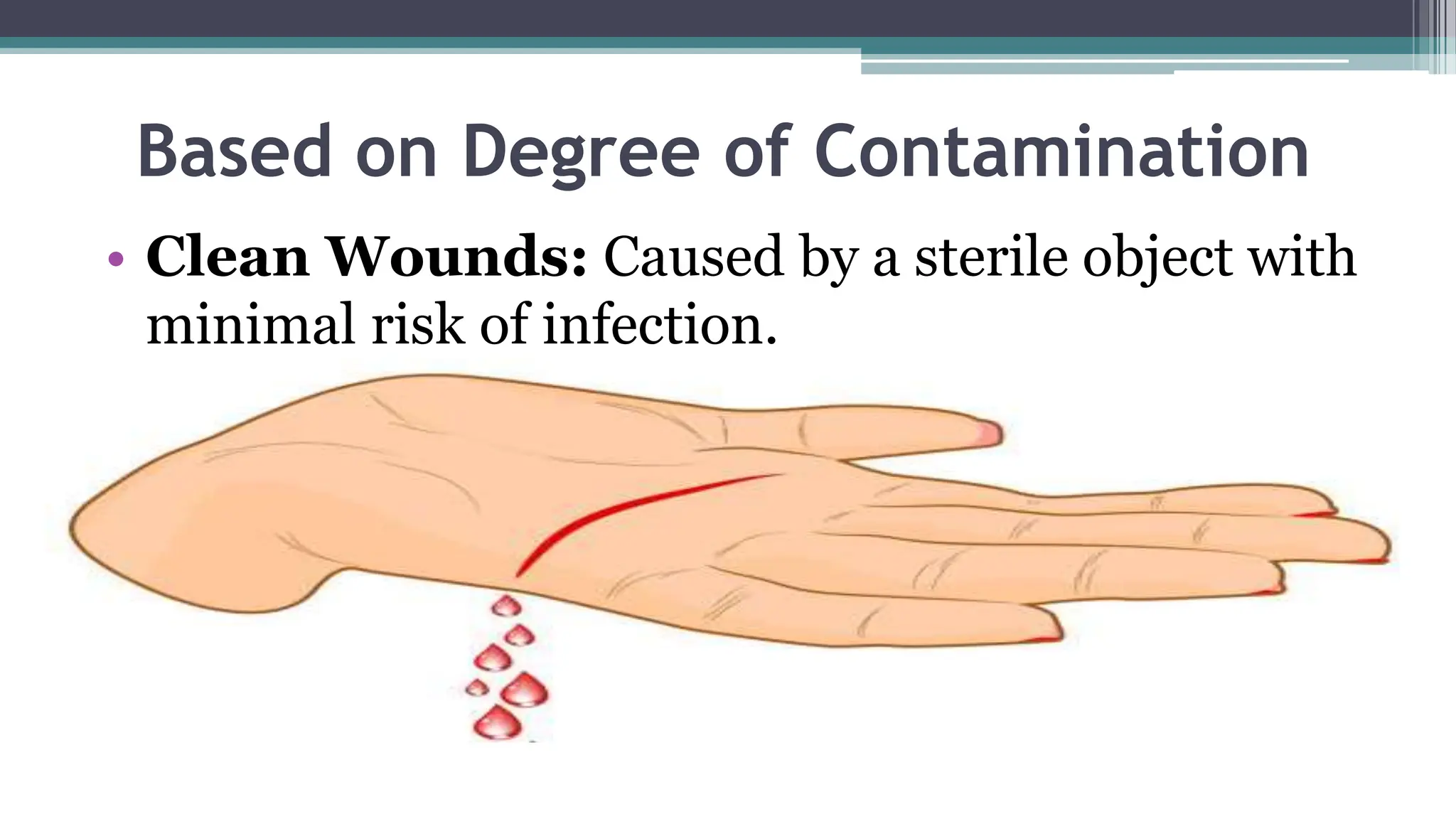 WOUNDS, wound healing process types of wounds.pptx | Death, Injury, or ...