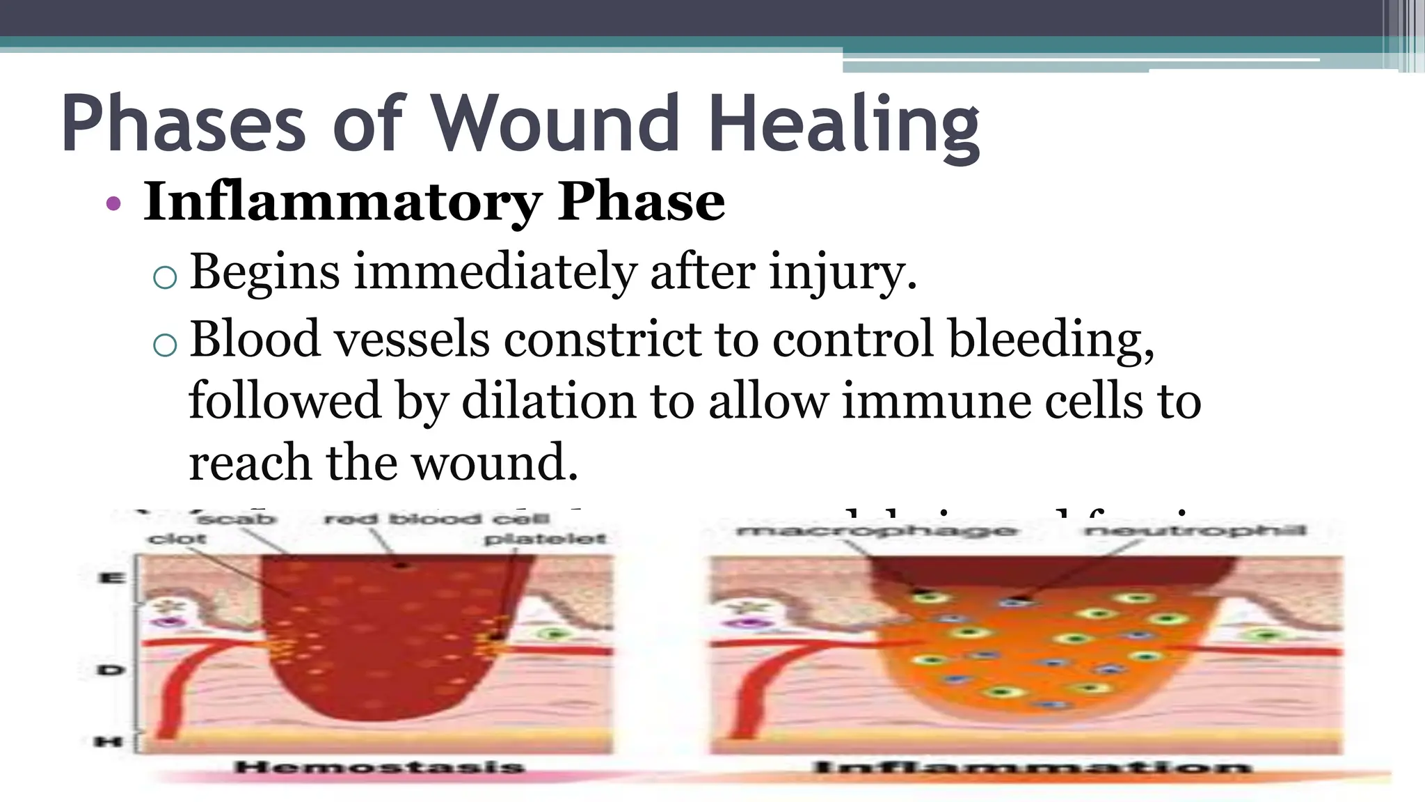 WOUNDS, wound healing process types of wounds.pptx | Death, Injury, or ...