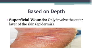 WOUNDS, wound healing process types of wounds.pptx