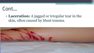 WOUNDS, wound healing process types of wounds.pptx | Death, Injury, or ...