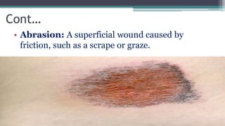 WOUNDS, wound healing process types of wounds.pptx