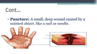 WOUNDS, wound healing process types of wounds.pptx | Death, Injury, or ...