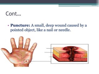 Wounds, types of wounds, wound healing process, complications of wound ...