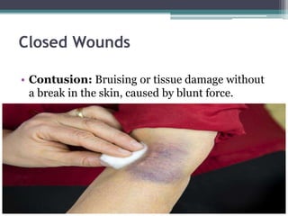 Wounds, types of wounds, wound healing process, complications of wound ...