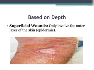 Wounds, types of wounds, wound healing process, complications of wound ...