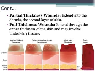 Wounds, types of wounds, wound healing process, complications of wound ...