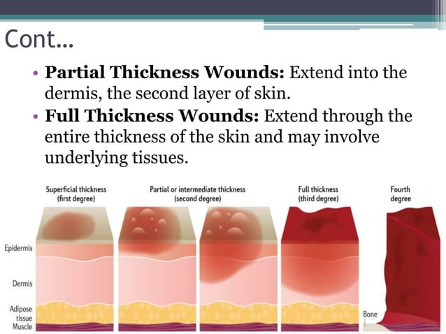 Wounds, types of wounds, wound healing process, complications of wound ...