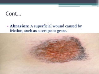 Wounds, types of wounds, wound healing process, complications of wound ...
