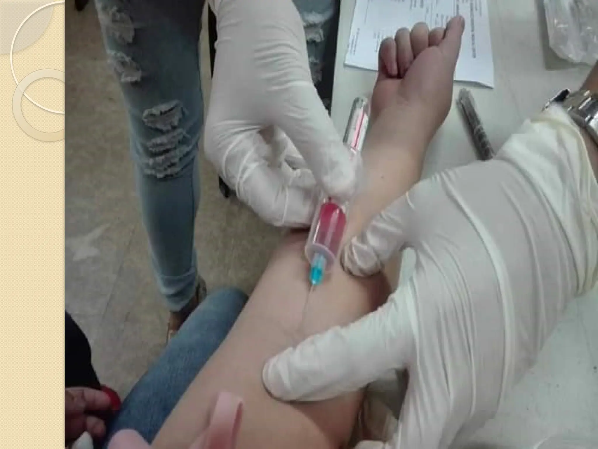 types of wounds mapeh - health quater 3 | PPTX