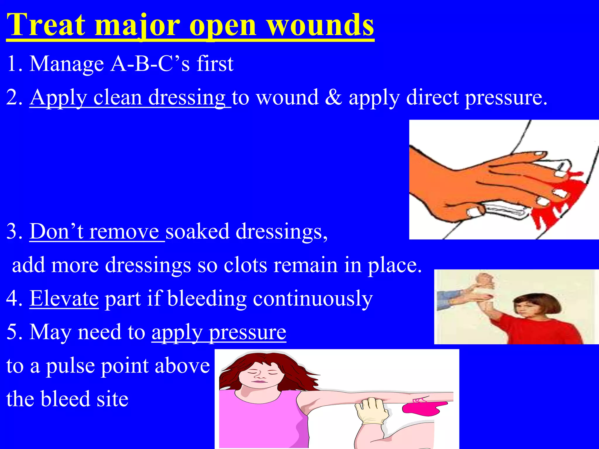 First Aid for Wounds | PPT