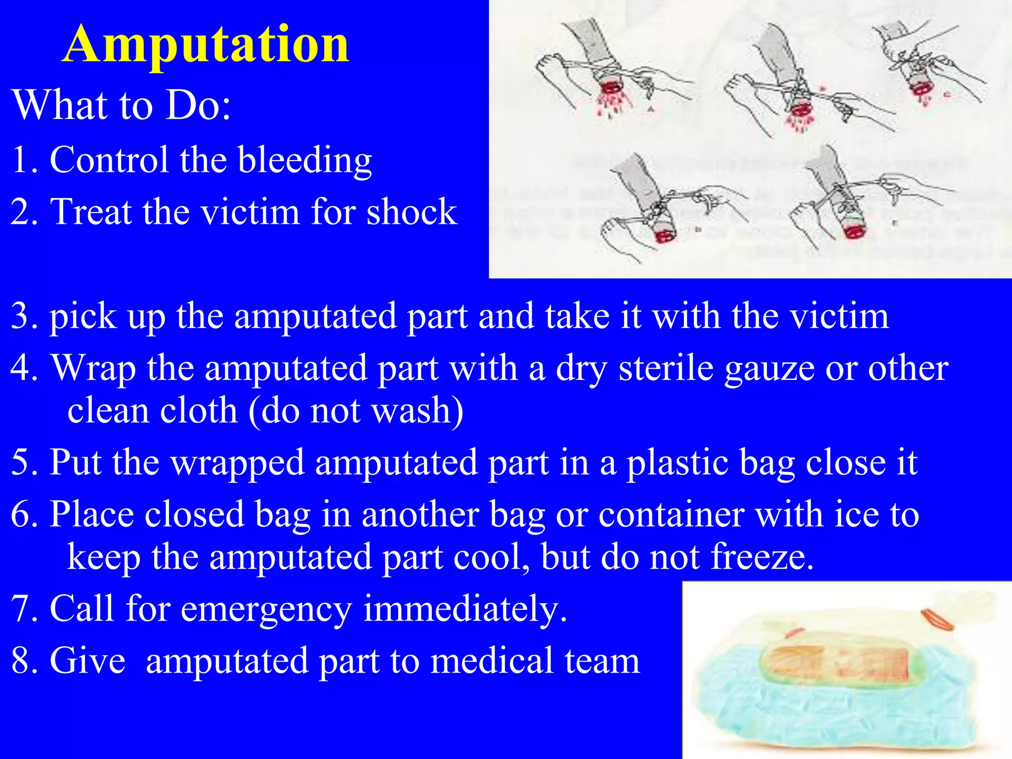 First Aid for Wounds | PPT