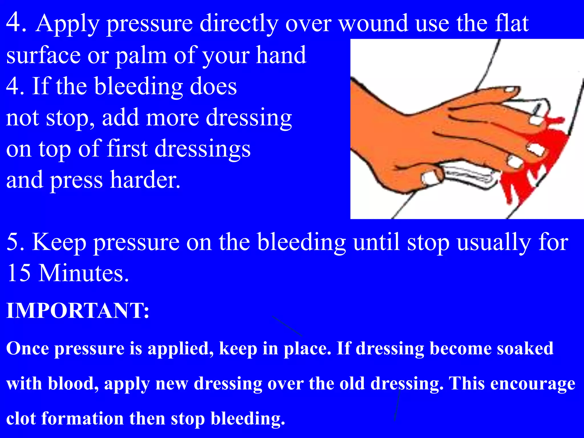 First Aid for Wounds | PPT