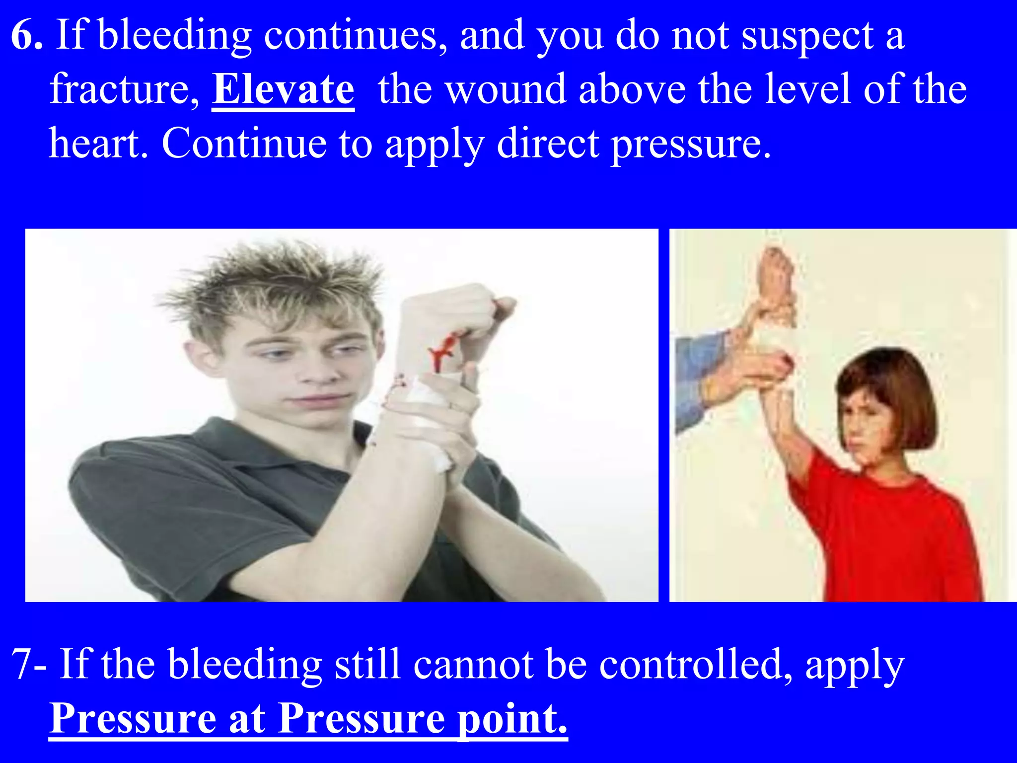 First Aid for Wounds | PPT