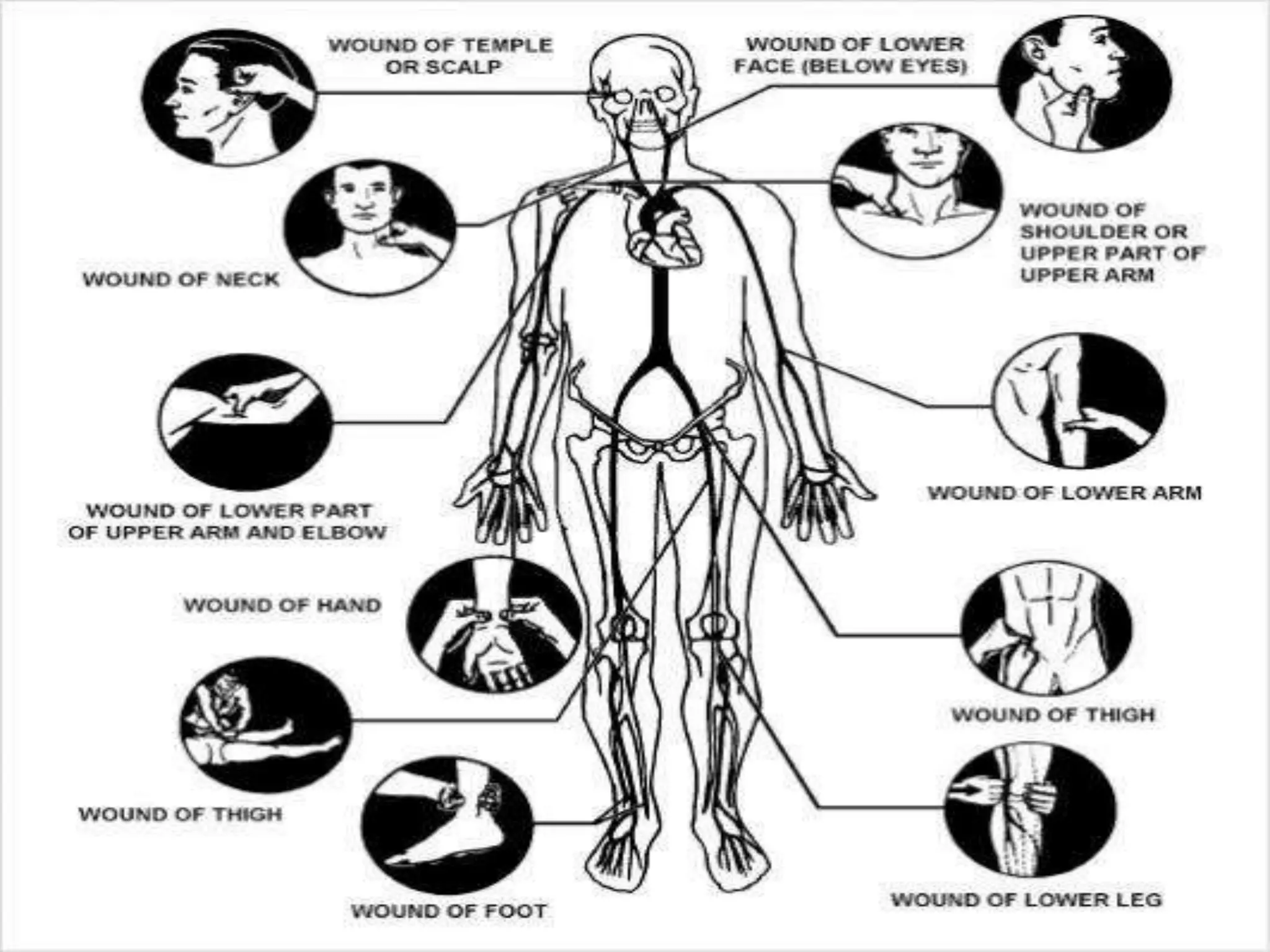 First Aid for Wounds | PPT