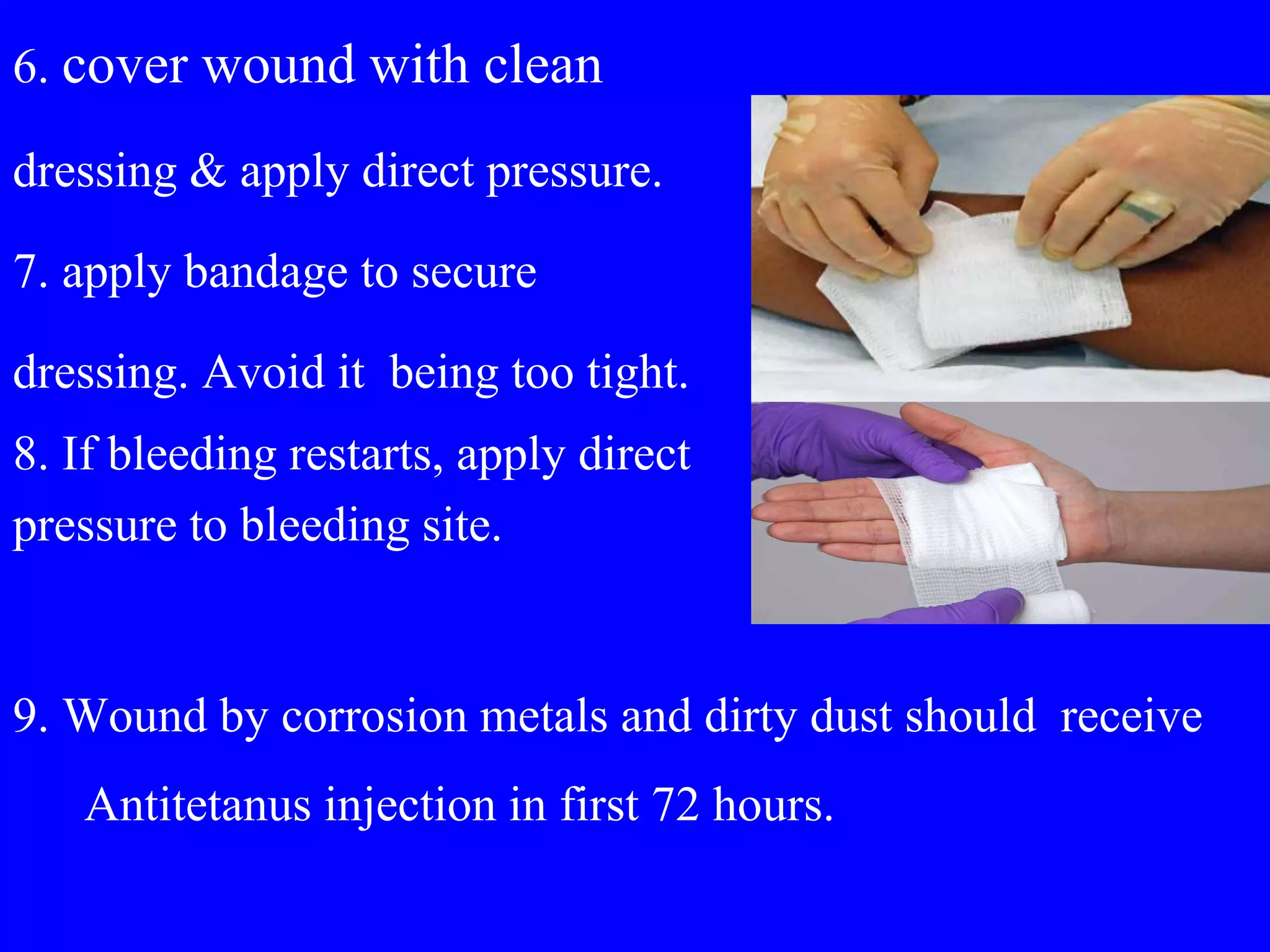 First Aid for Wounds | PPT