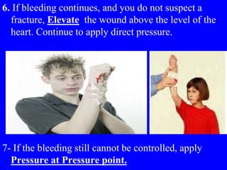 First Aid for Wounds | PPT | First Aid | Injuries