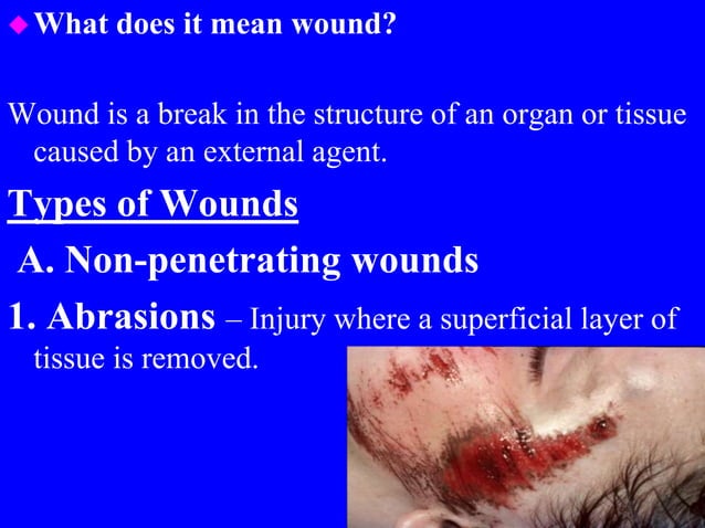 First Aid for Wounds | PPT | First Aid | Injuries
