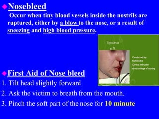 First Aid for Wounds | PPT