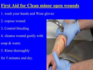 First Aid for Wounds | PPT