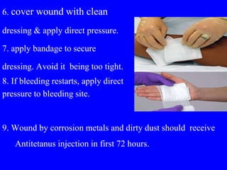 First Aid for Wounds | PPT