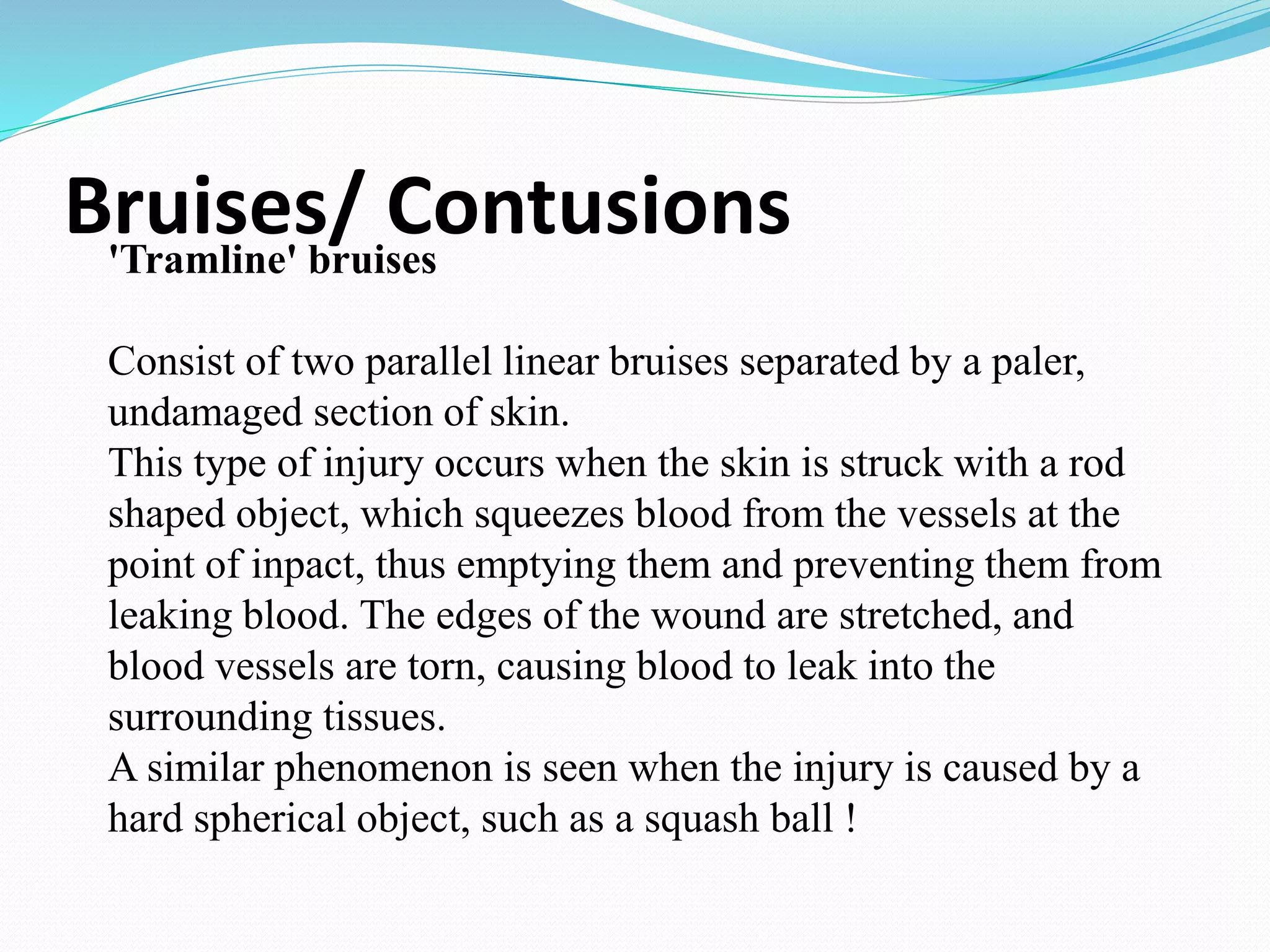 Wounds lecture-drneerajjain | PPTX