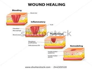 Wounds And wound dressing (Advanced Nursing I) .pptx