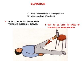 Wounds and bleeding | PPTX