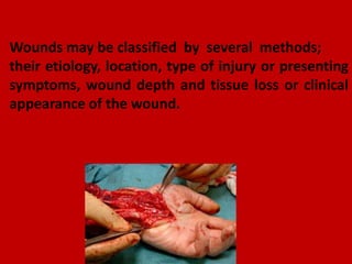 Wounds and bleeding | PPTX