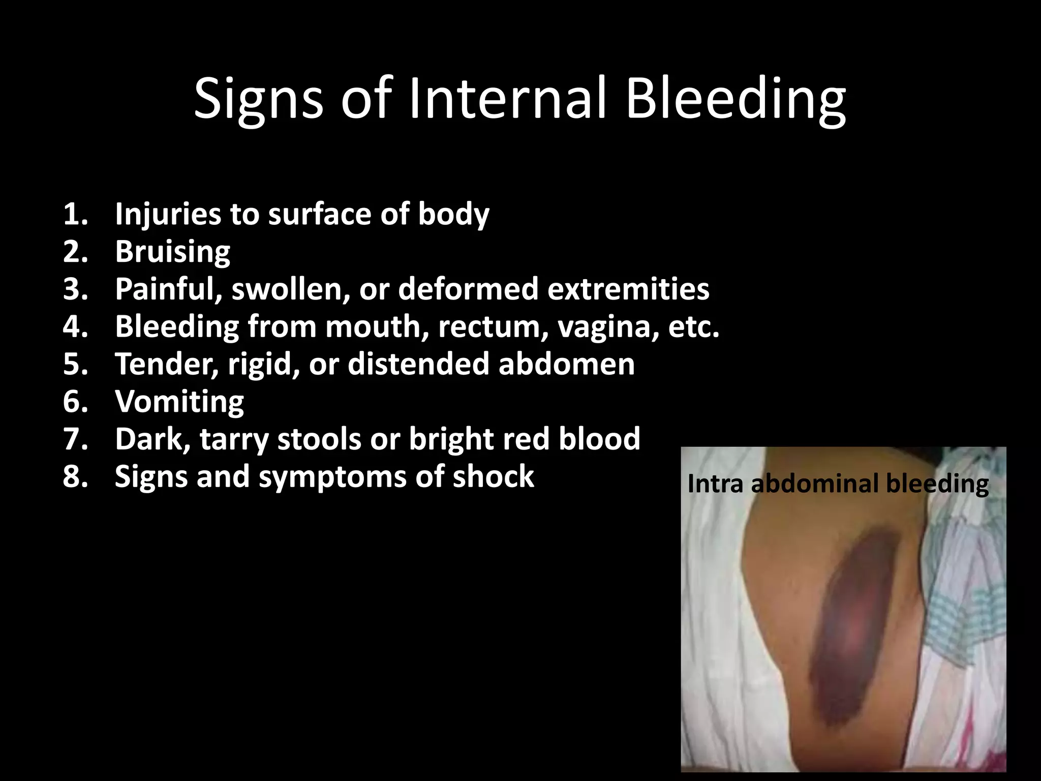 Wounds and bleeding | PPTX