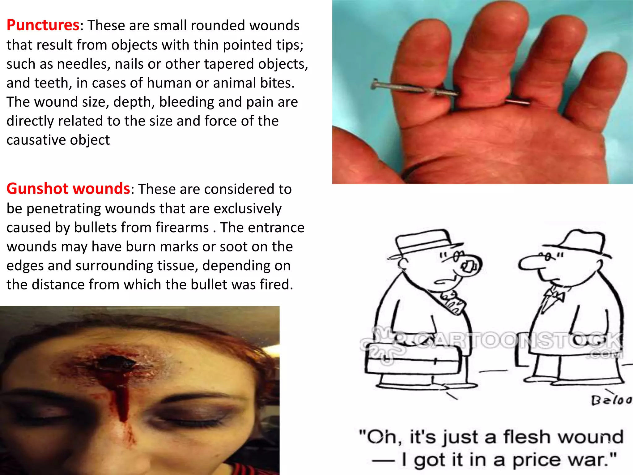 Wounds and bleeding | PPTX