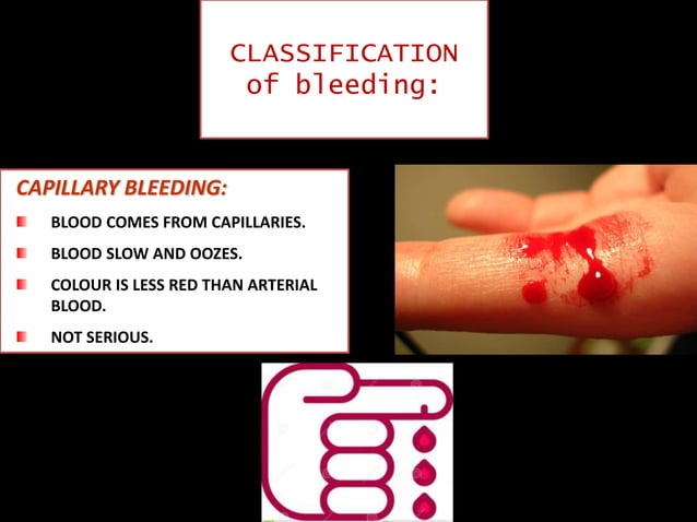 Wounds and bleeding | PPT