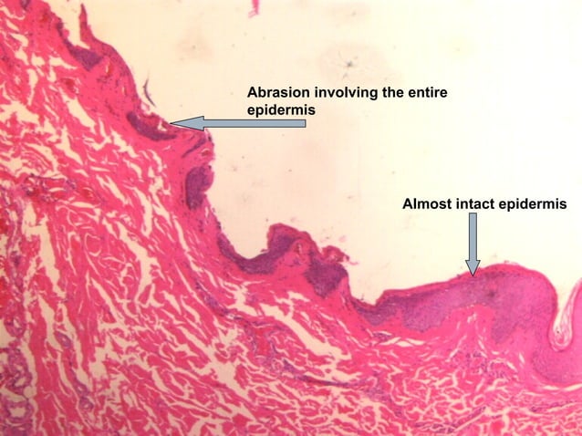 wounds_and_their_medico-legal_importance.ppt