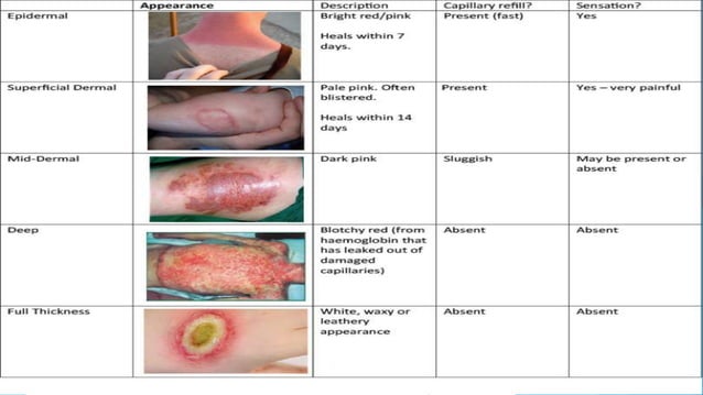 WOUNDS AND WOUND HEALING-1.pptx | First Aid | Injuries