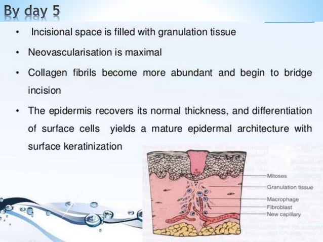 Wounds and wound healing | PPTX | First Aid | Injuries