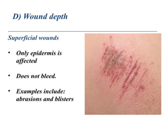 Wounds and Wound healing types and their managments .pptx