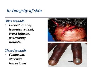 Wounds and Wound healing types and their managments .pptx