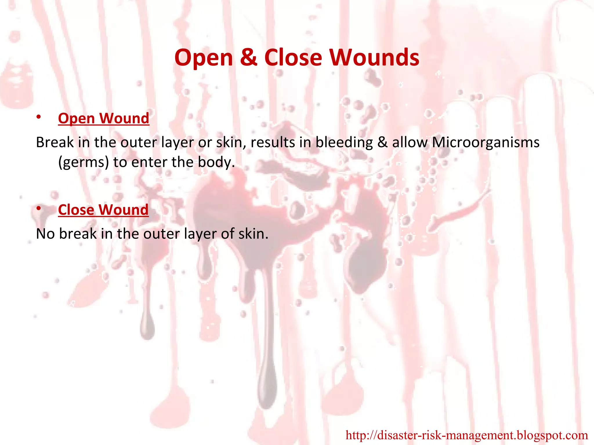 Wounds and Bleeding | PPT