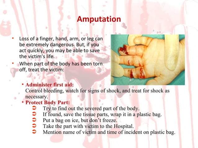 Wounds and Bleeding | PPT
