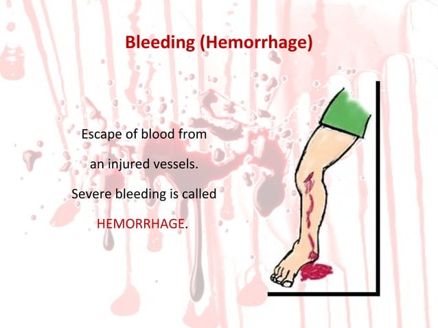Wounds and Bleeding | PPT