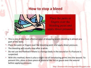 Wounds and Bleeding | PPT