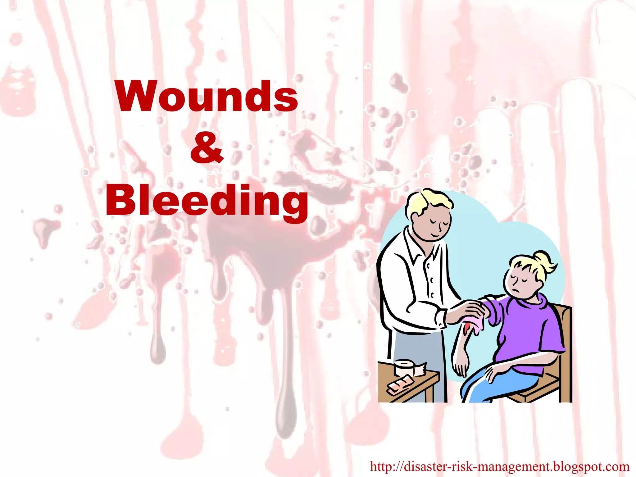 Wounds and Bleeding | PPT