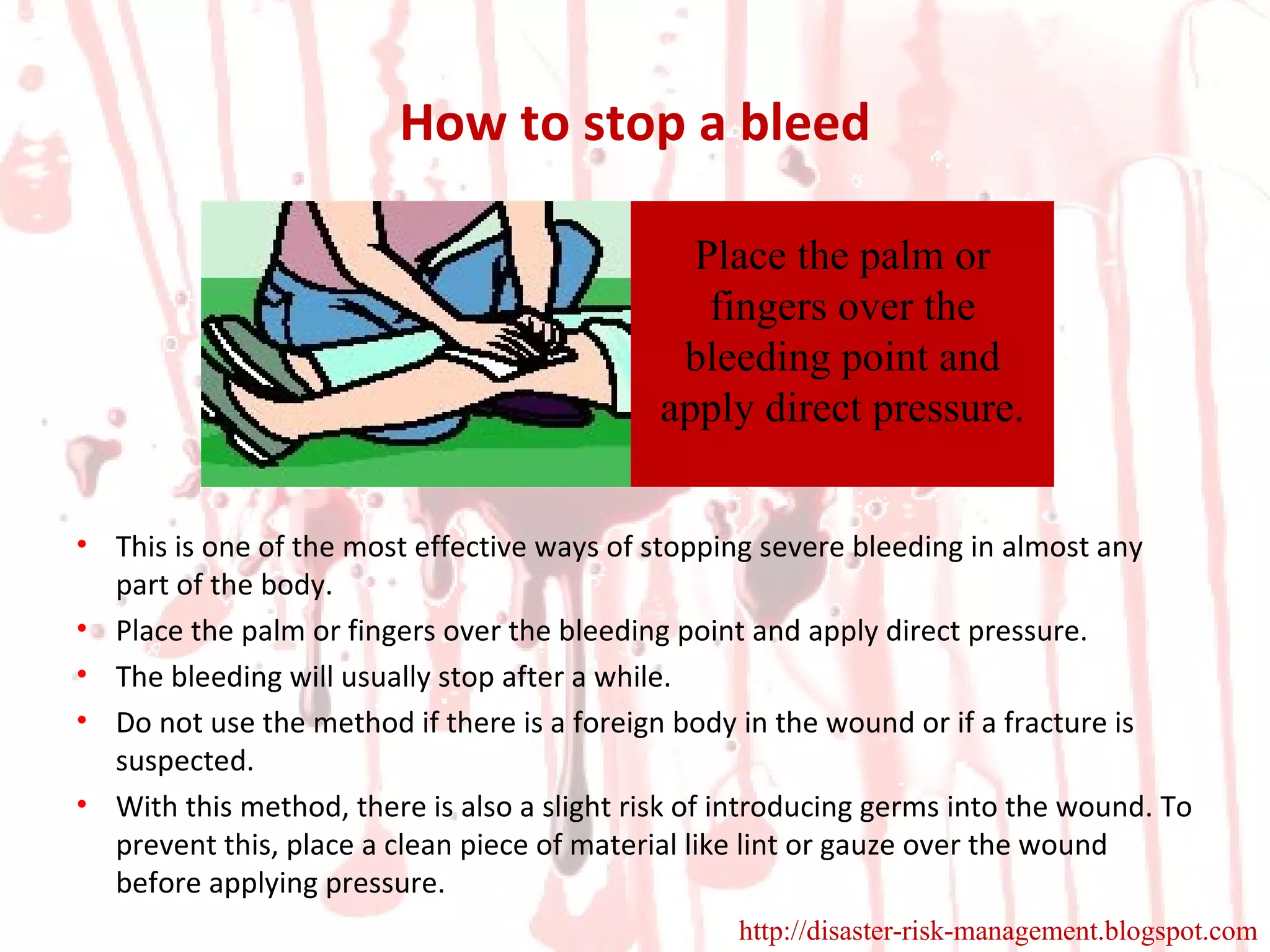 Wounds and Bleeding | PPT
