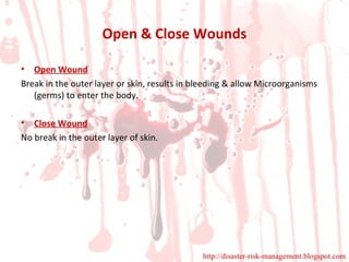 Wounds and Bleeding | PPT