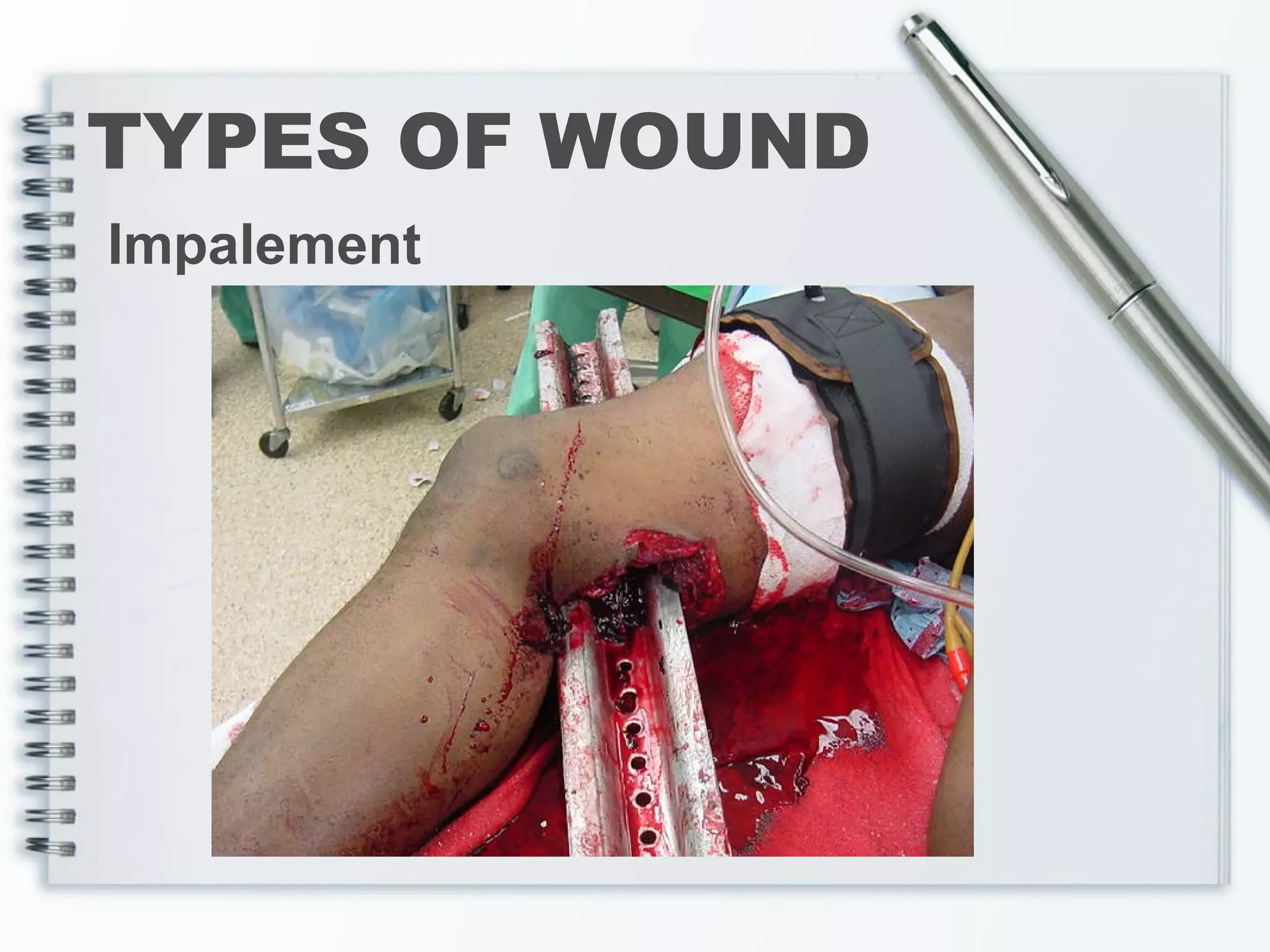 Wounds & bleeding_slides | PPT | First Aid | Injuries