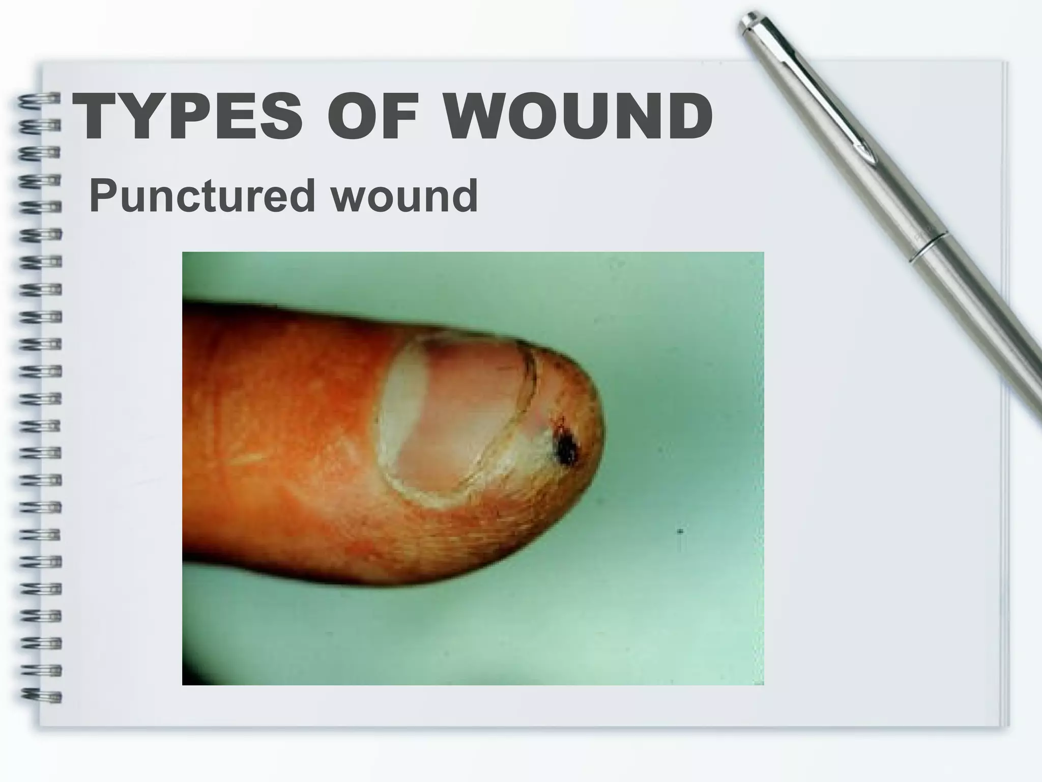 Wounds & bleeding_slides | PPT