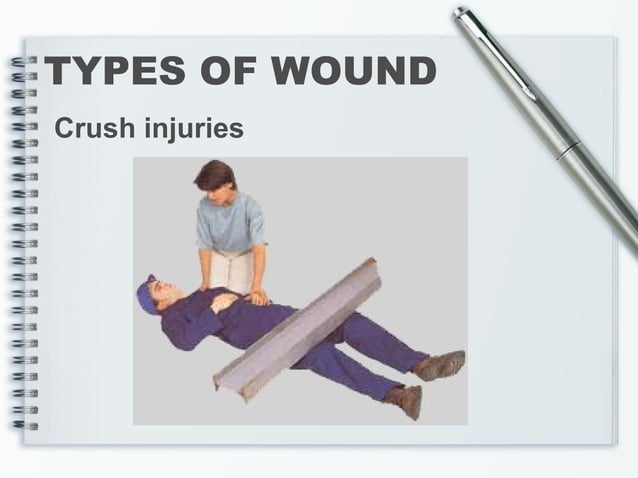Wounds & bleeding_slides | PPT | First Aid | Injuries