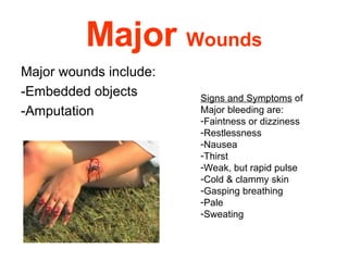 Wounds