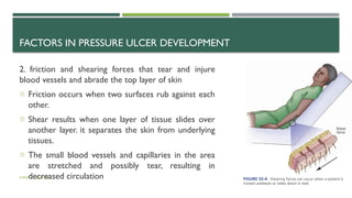 wound ; cause ,classification , healing phases ,pressure ulcer , wound ...