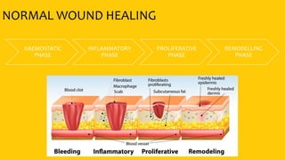 Wounds, healing and tissue repair | PPTX