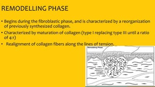 Wounds, healing and tissue repair | PPTX